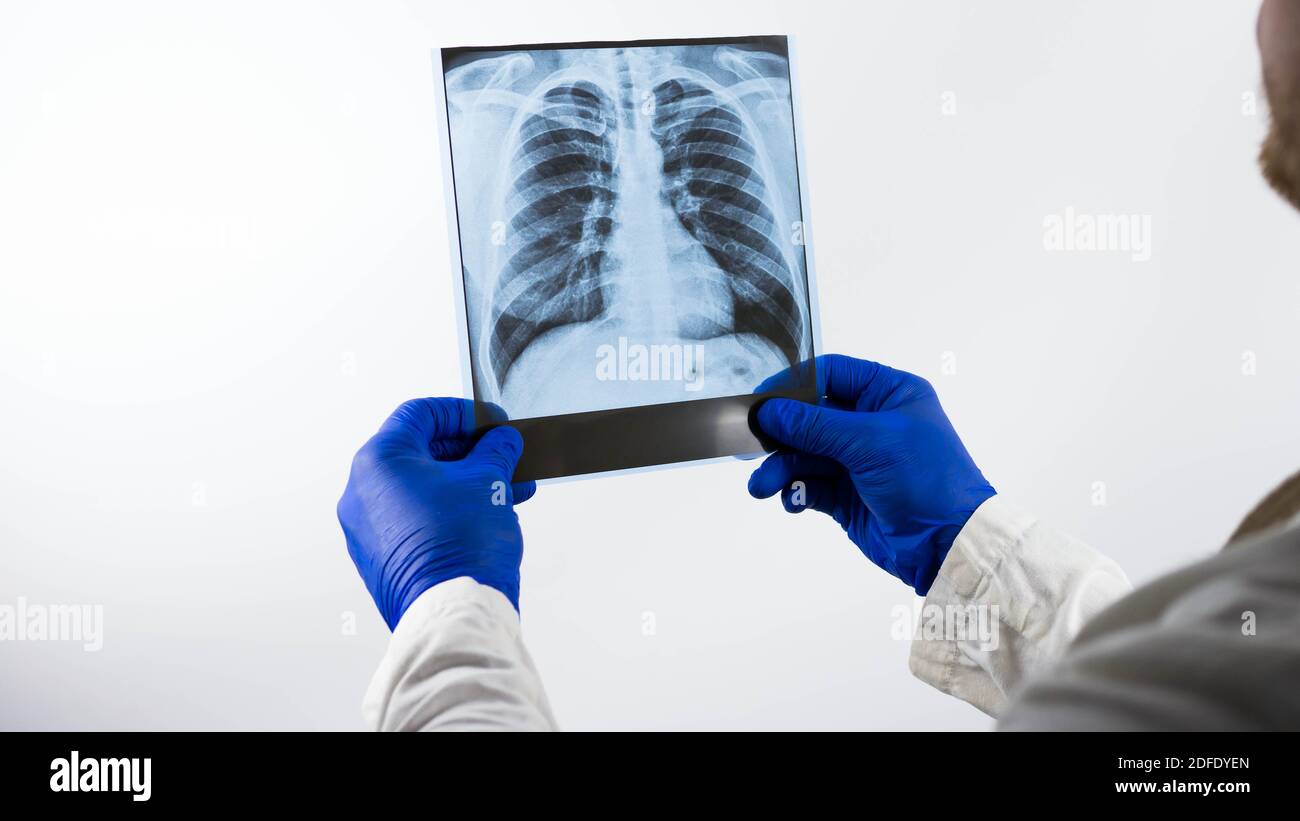 X-ray of human lungs on a white background in the hands of a doctor,X ...