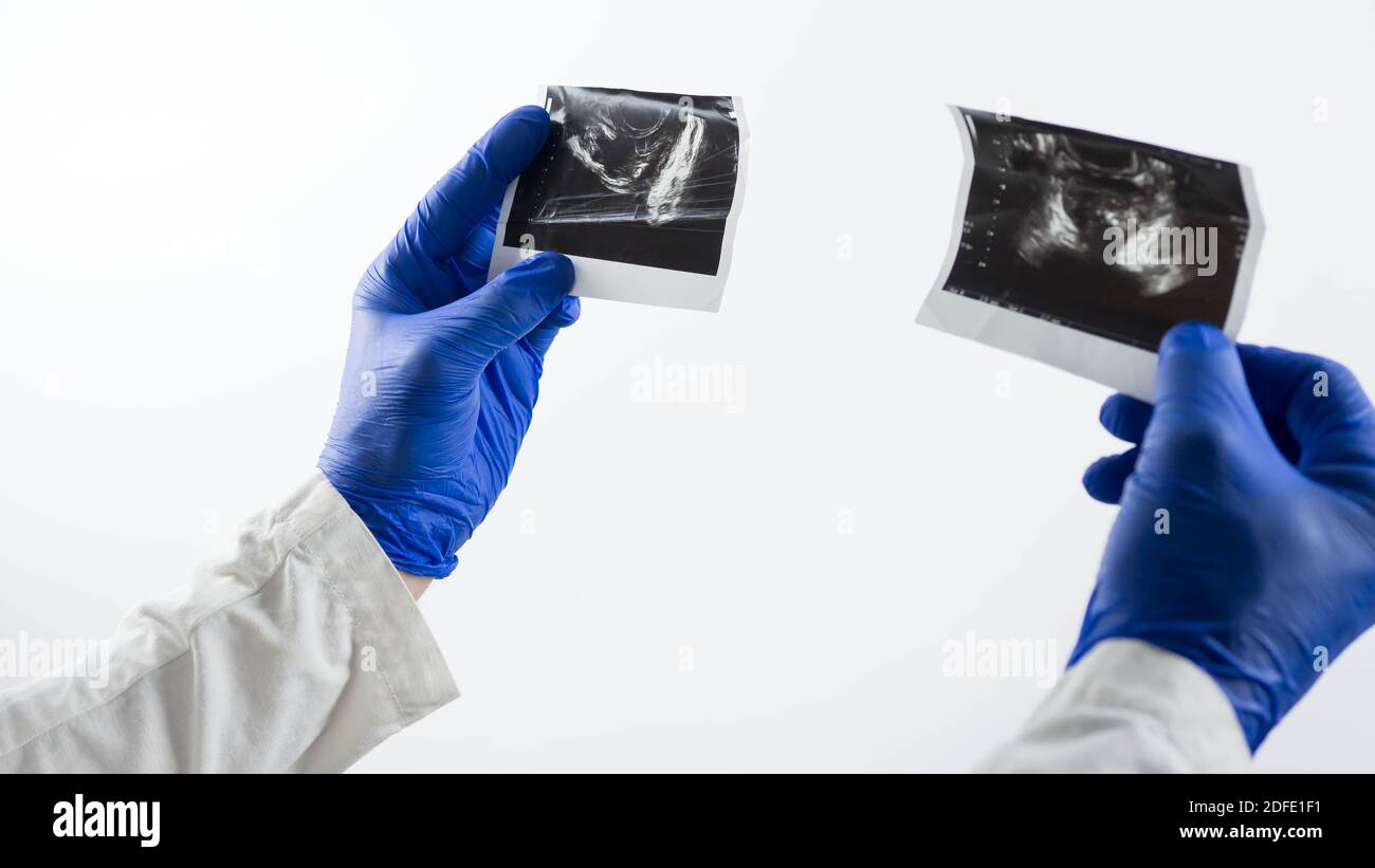 The doctor examines the pictures of the prostate gland, analysis of the ...