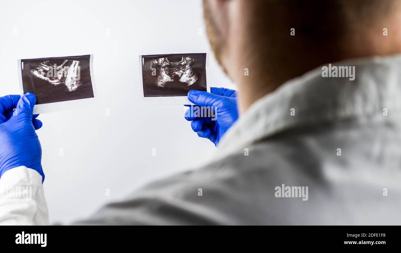 The doctor examines the ultrasound images of the prostate gland ...
