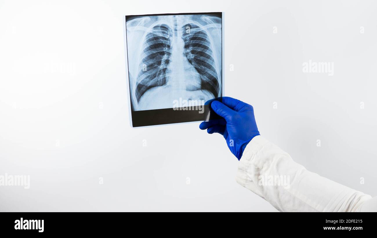 Edema examination hi-res stock photography and images - Alamy