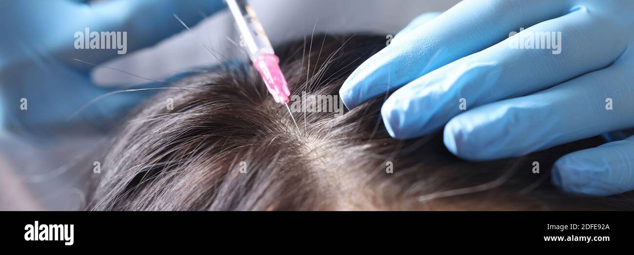 Trichologist makes an injection into scalp closeup Stock Photo - Alamy