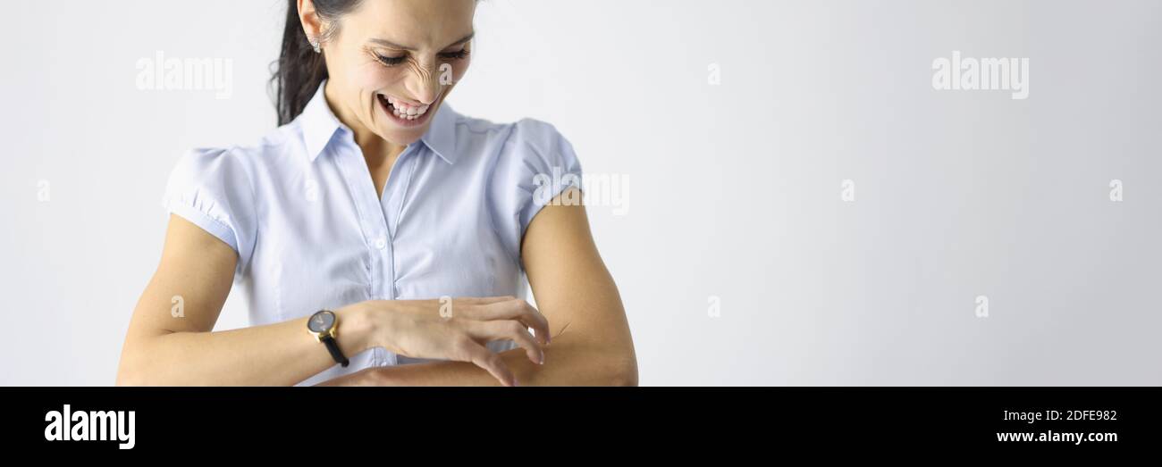 Irritated woman scratches her hand violently closeup Stock Photo - Alamy