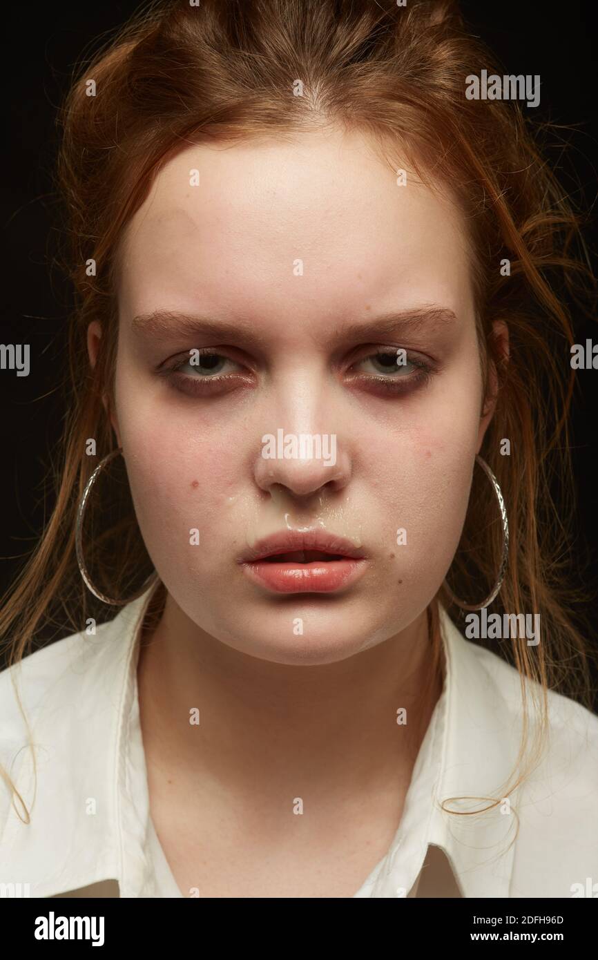 sad face of a cold girl with a flu with a runny nose and a temperature ...