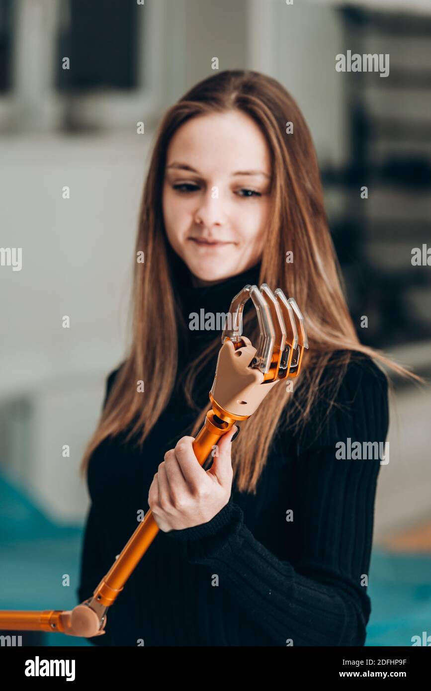 Prosthetic arms girl hi-res stock photography and images - Alamy