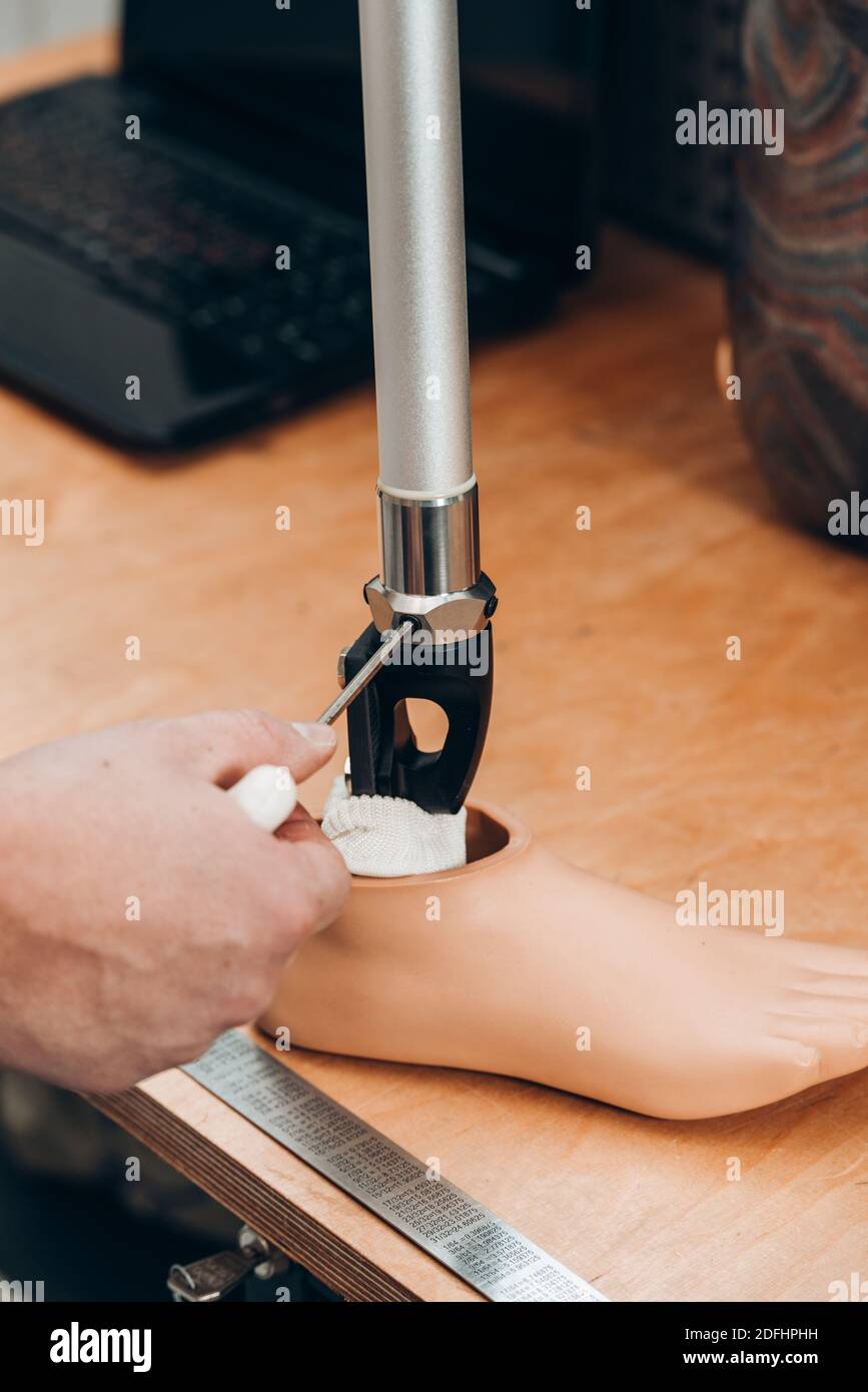 Prosthetic limb adjusting hi-res stock photography and images - Alamy