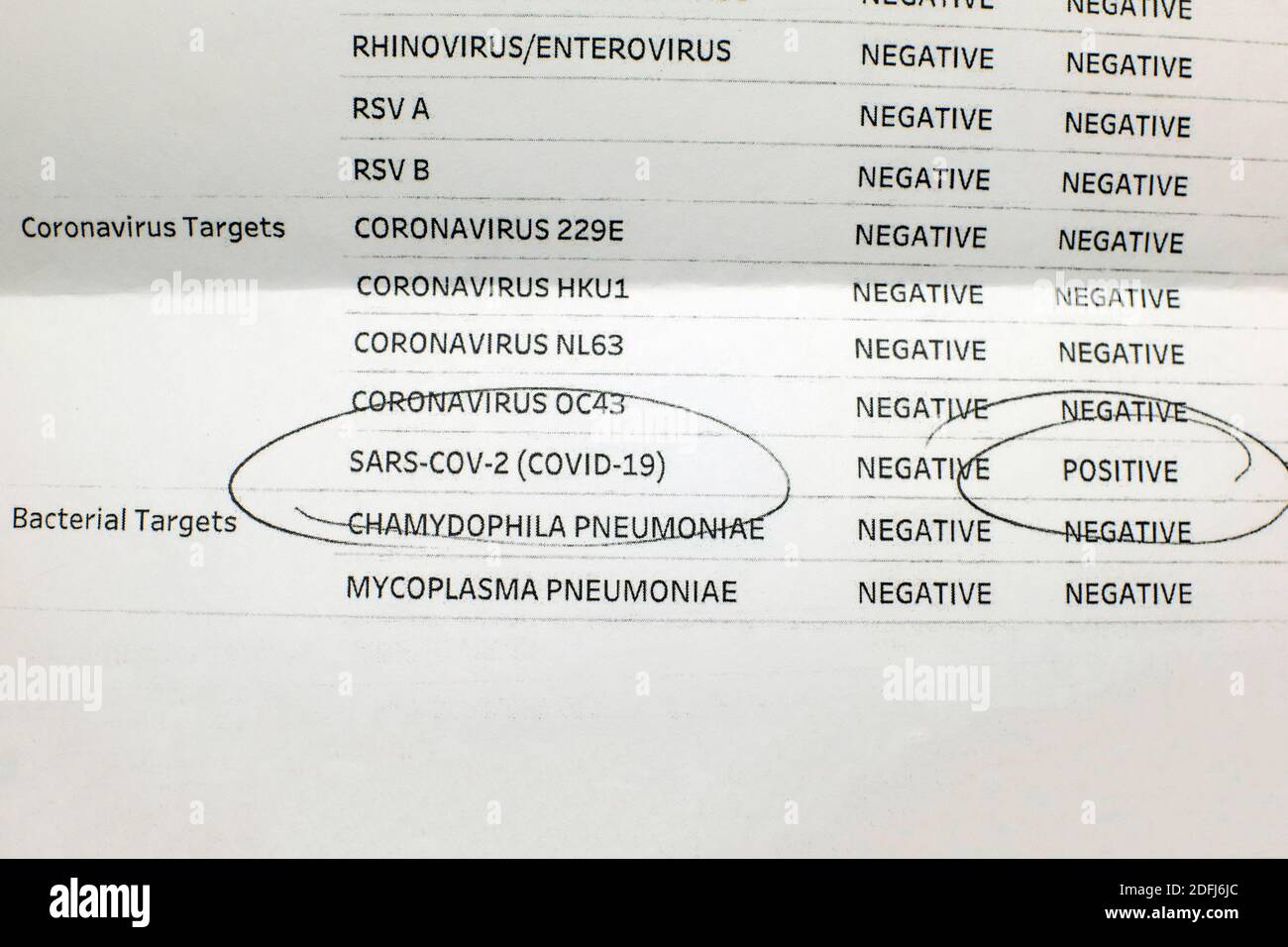 Positive covid test hi-res stock photography and images - Alamy