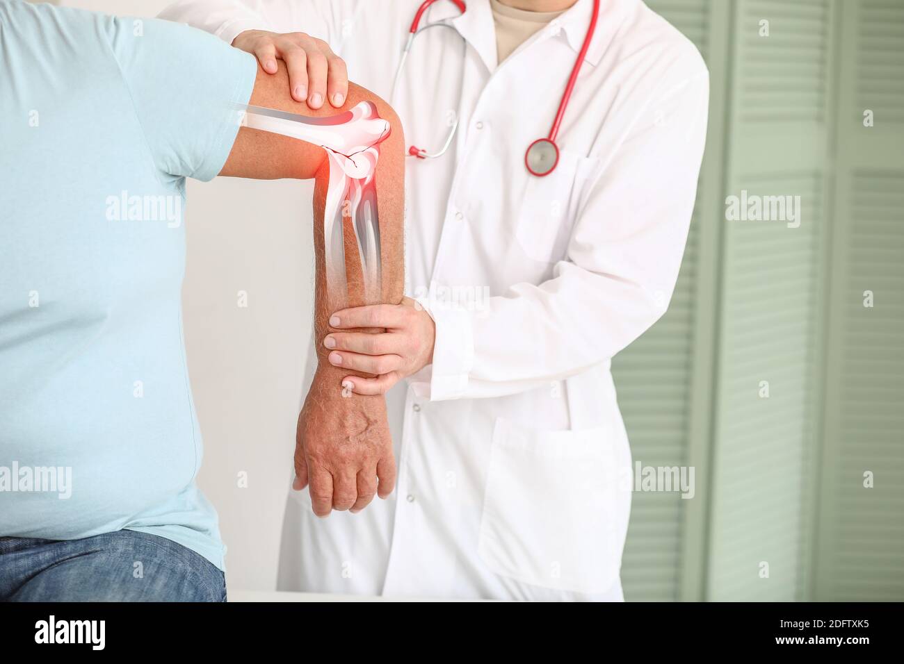 Broken upper arm bone hi-res stock photography and images - Alamy