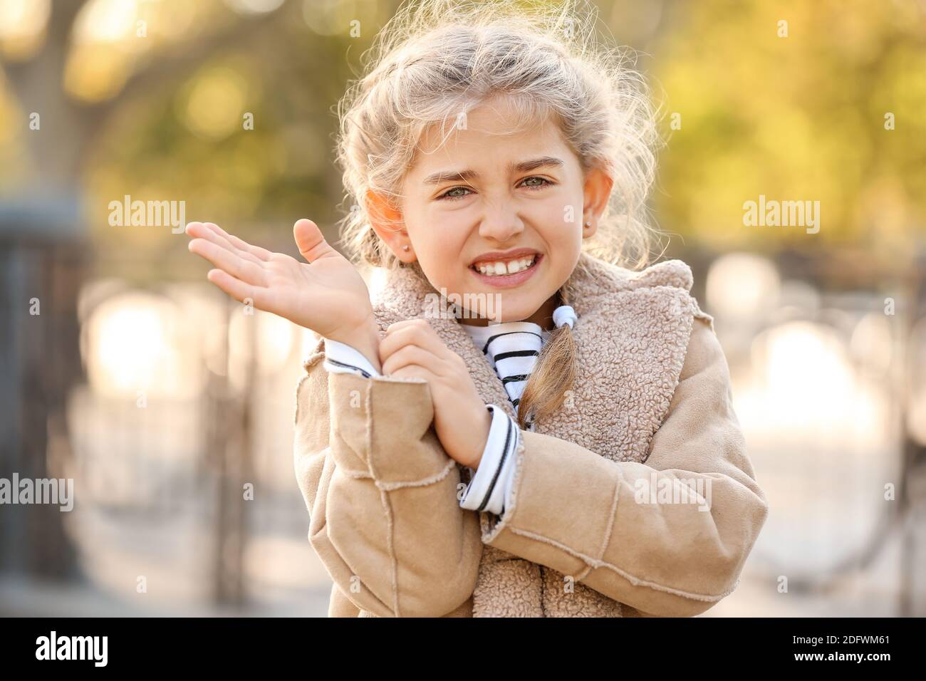 Allergic little girl scratching herself outdoors Stock Photo - Alamy