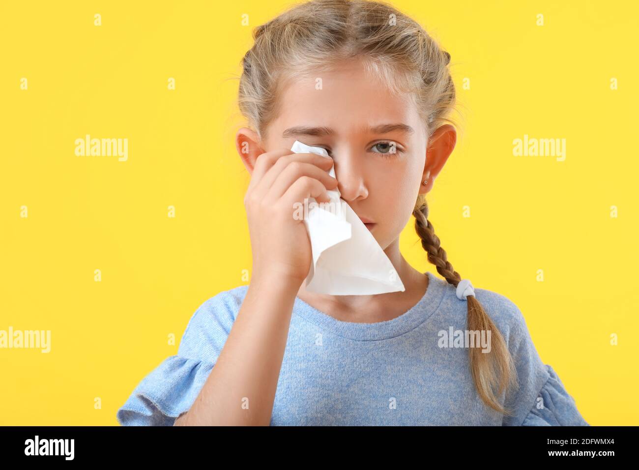 Little allergic girl on color background Stock Photo - Alamy