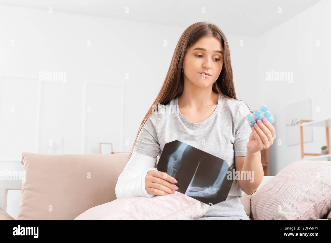 Young woman with broken arm at home Stock Photo - Alamy