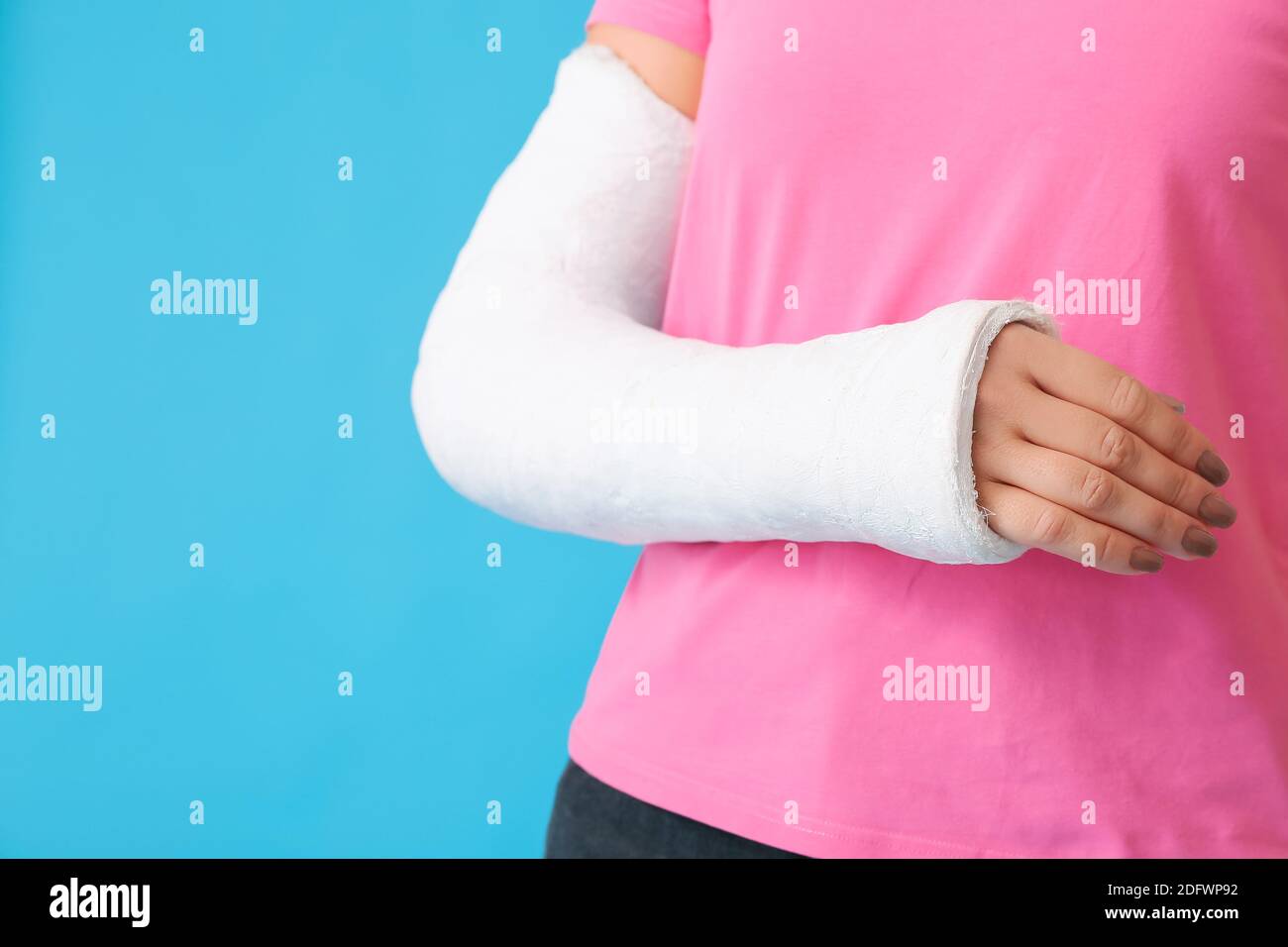 Young woman with broken arm on color background, closeup Stock Photo ...