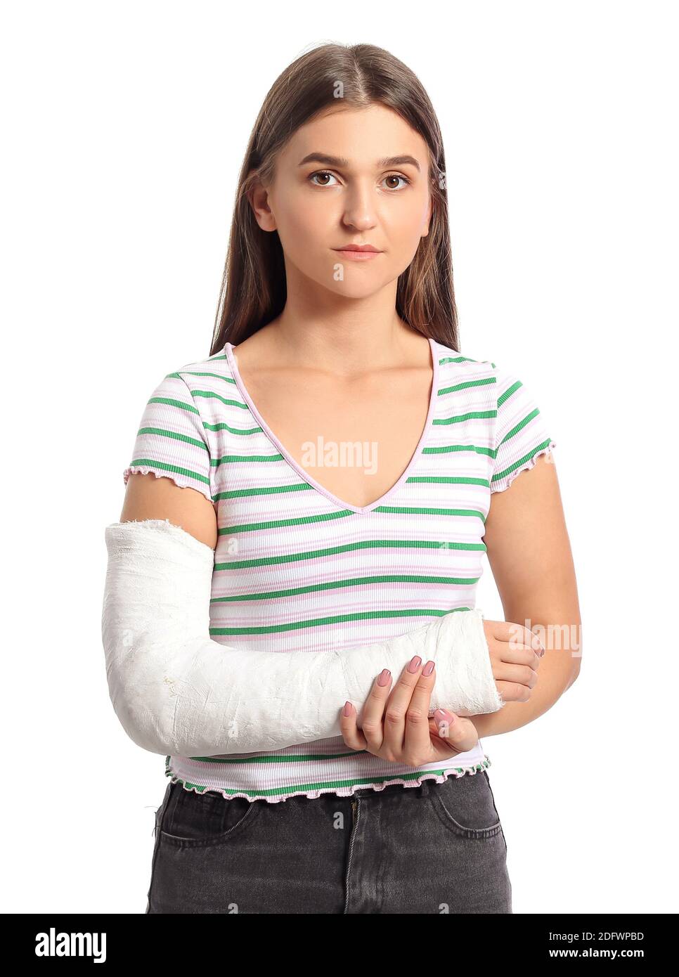Young woman with broken arm on white background Stock Photo - Alamy