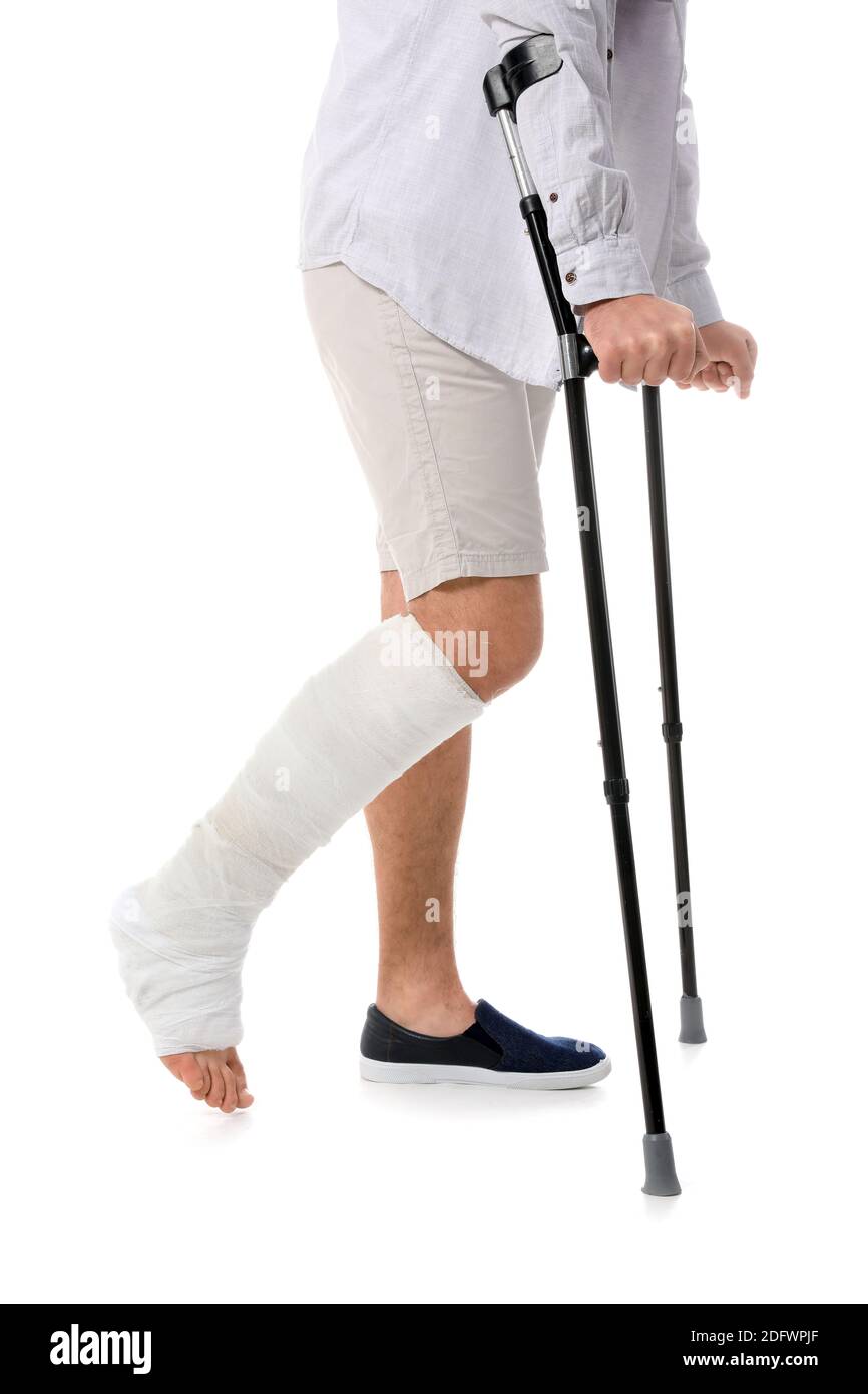 Young man with broken leg on white background Stock Photo - Alamy