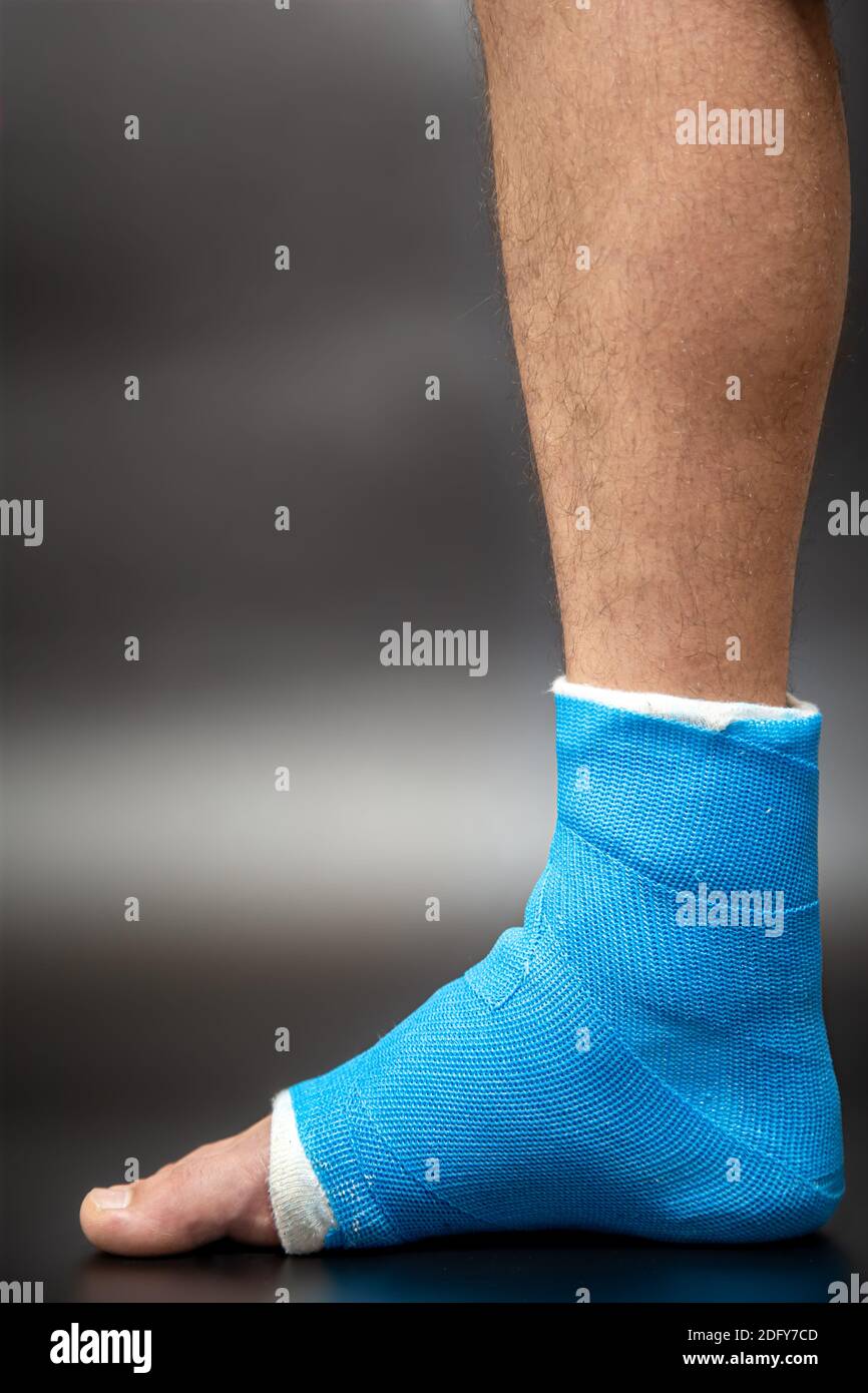 Blue splint ankle. Bandaged leg cast on male patient on dark blurred ...