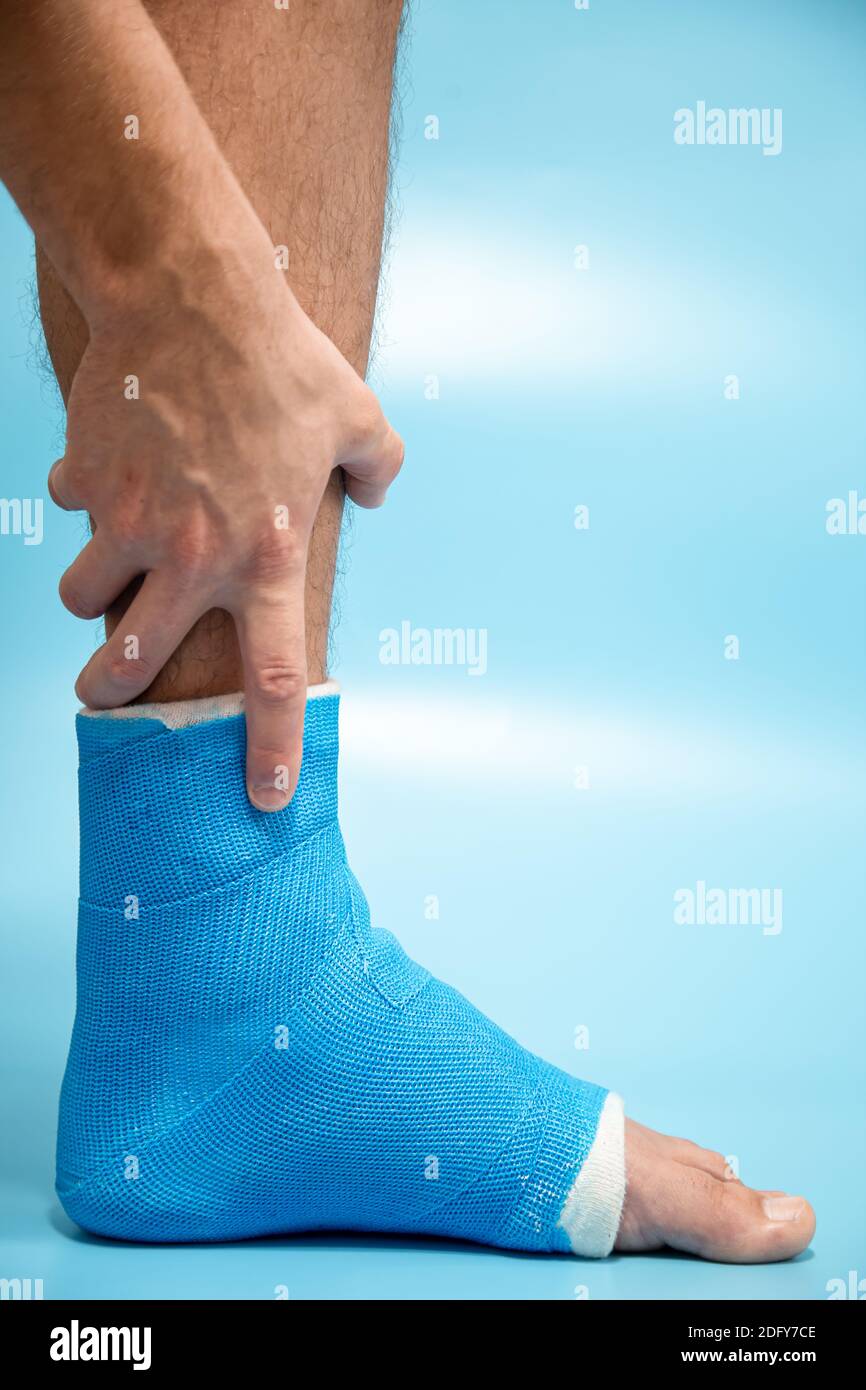 Blue splint ankle. Bandaged leg cast on male patient on light blue ...