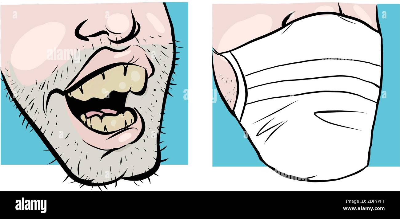 Vector illustration of surgical mask covering neglected teeth Stock ...