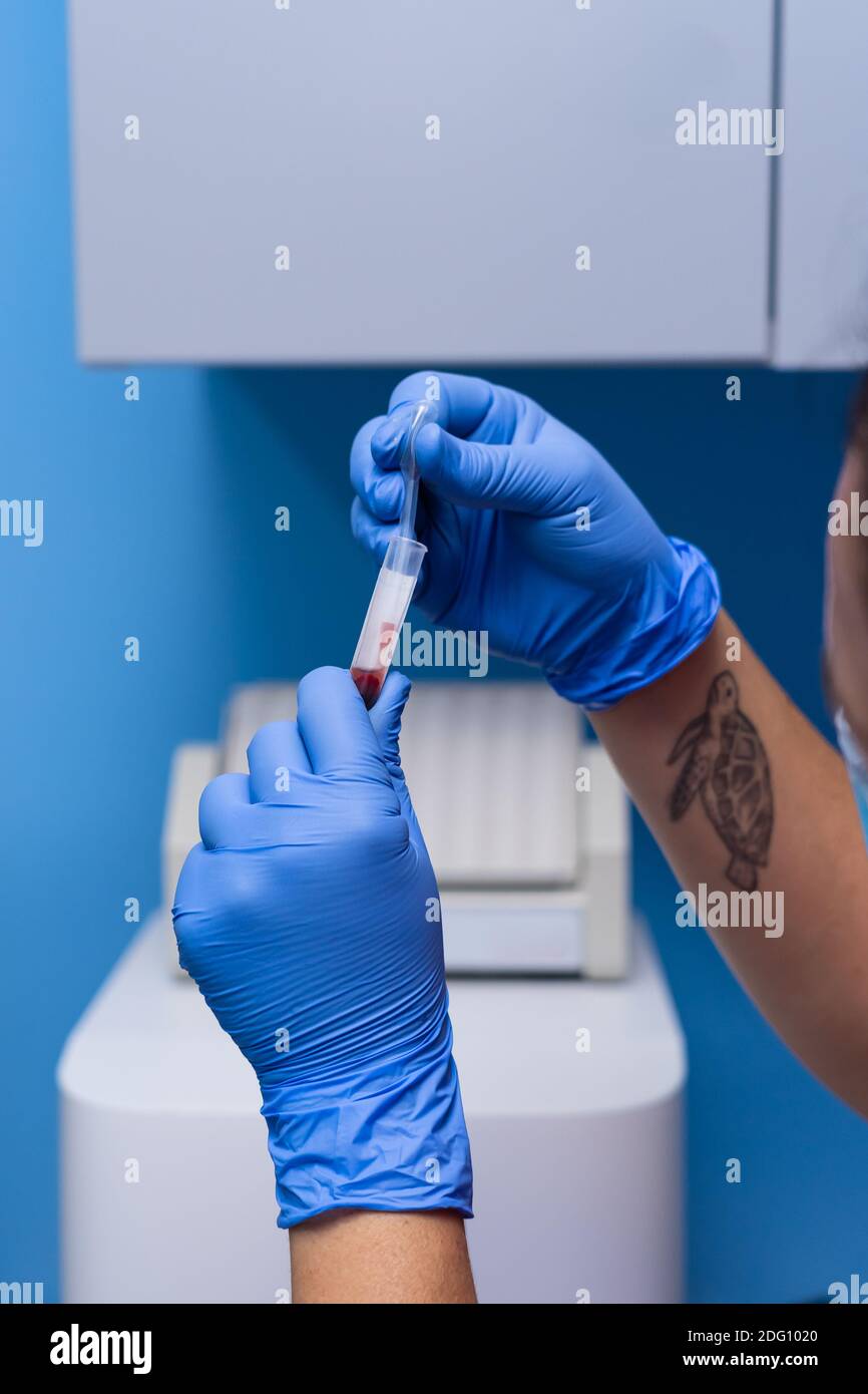 Separation of blood serum for blood chemistry Stock Photo - Alamy