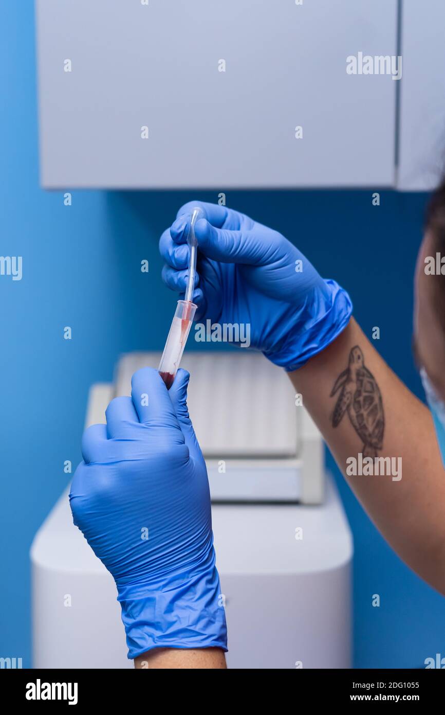 Separation of blood serum for blood chemistry Stock Photo - Alamy