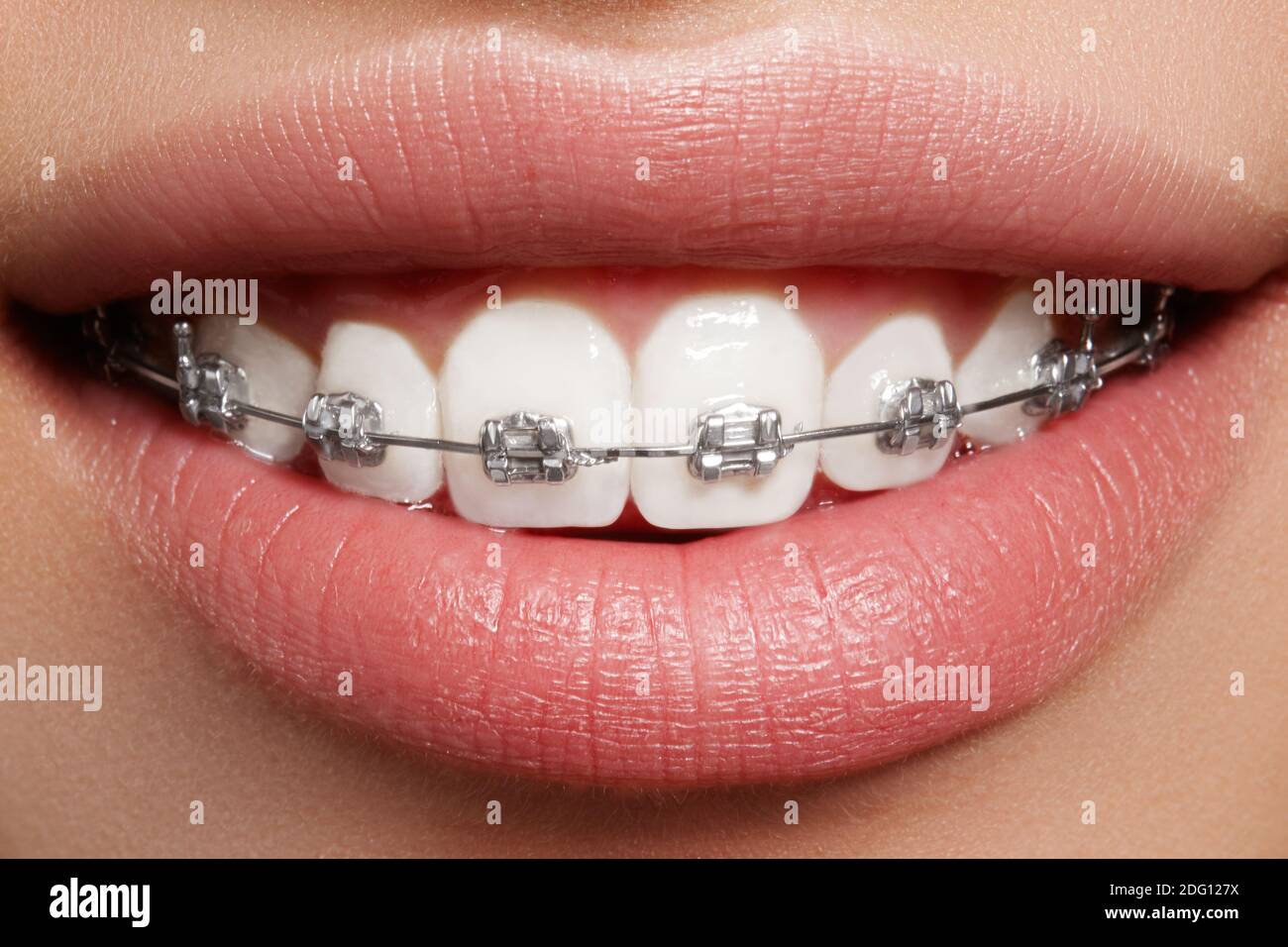 Close up woman mouth open teeth hi-res stock photography and images - Alamy