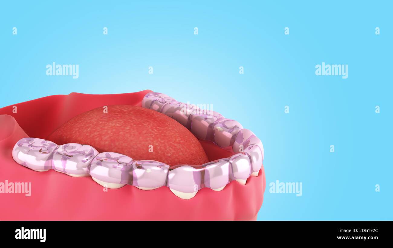 silicone braces on the display stand 3d render on blue gradient Stock ...