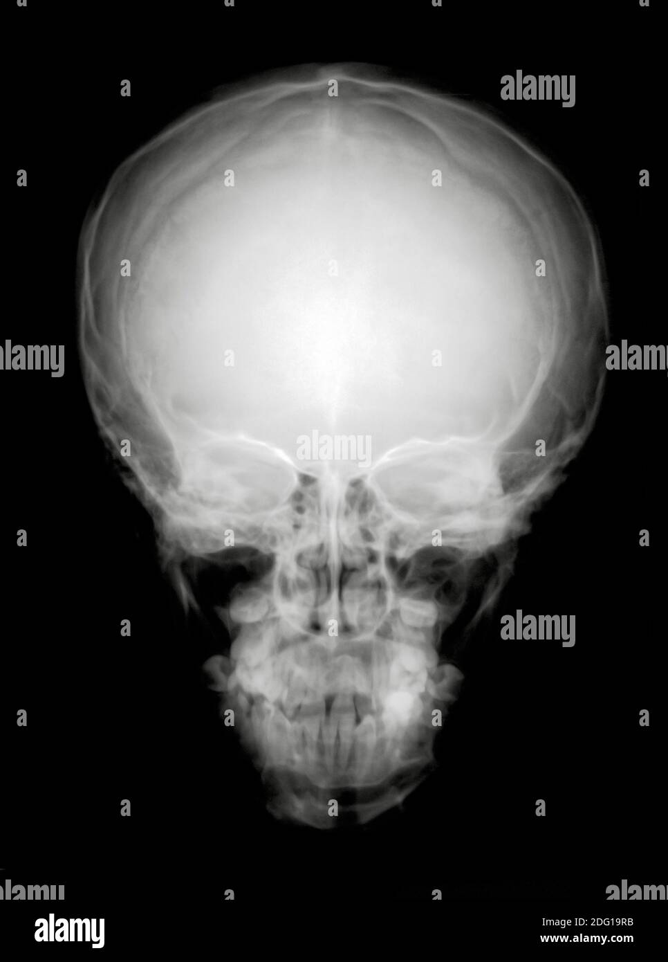 Head from front Stock Photo - Alamy