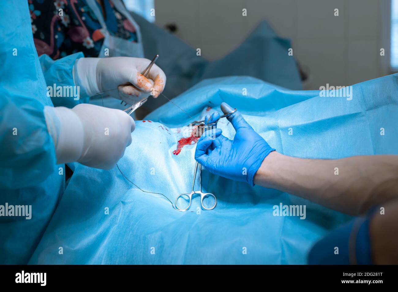 the surgeon applies a surgical clamp to stop the bleeding. Group of ...