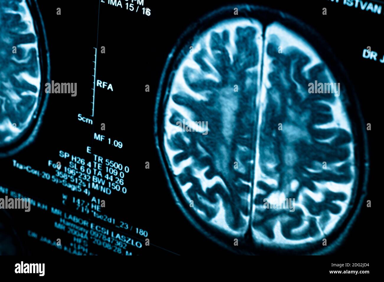 Ct scan brain cross section hi-res stock photography and images - Alamy