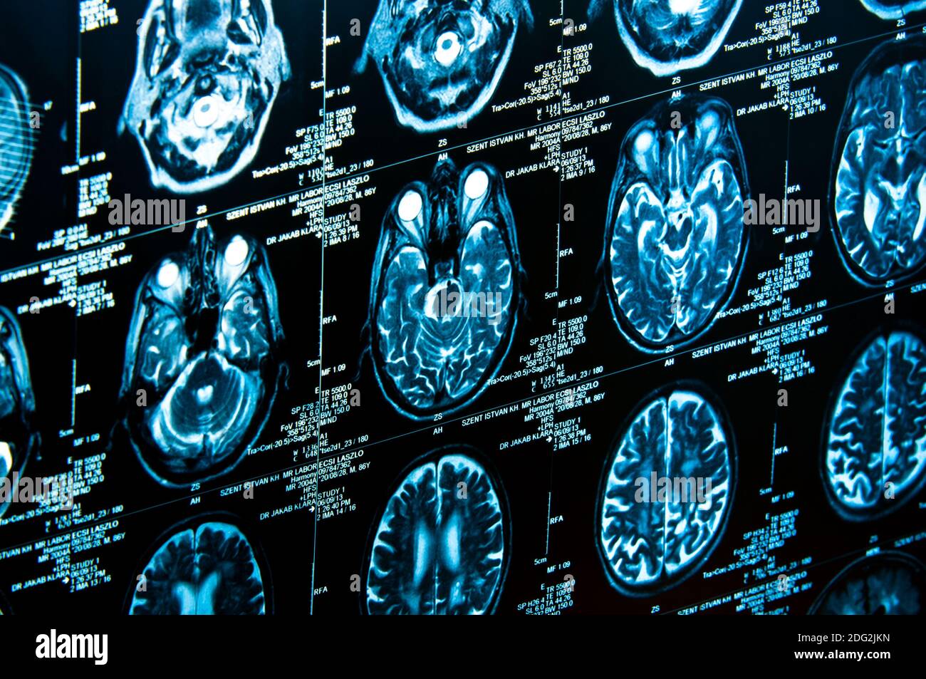 Ct scan brain cross section hi-res stock photography and images - Alamy
