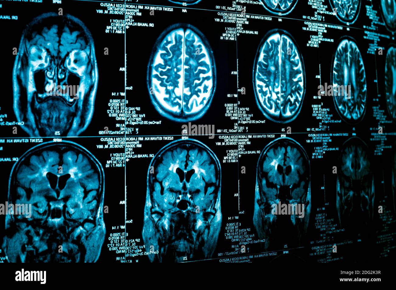 Neuron group hi-res stock photography and images - Alamy