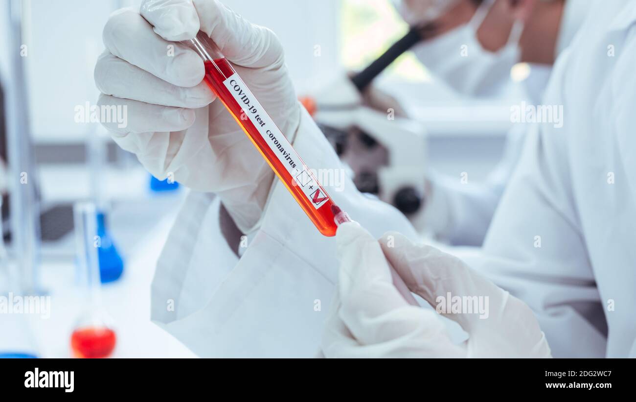 close up. lab technician making a mark on the tube with the test Stock ...
