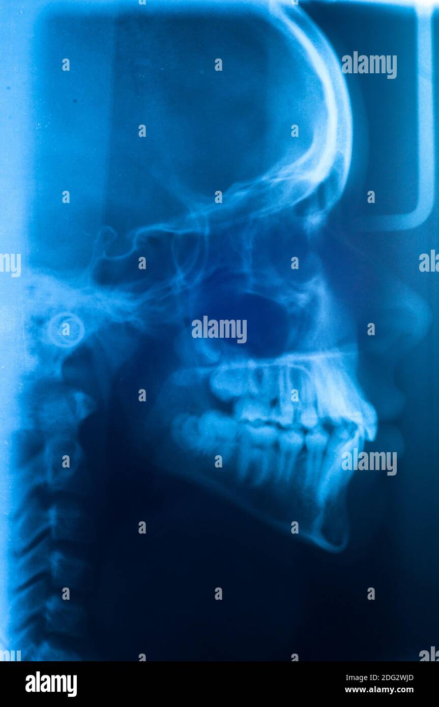 Anatomy closeup hi-res stock photography and images - Alamy