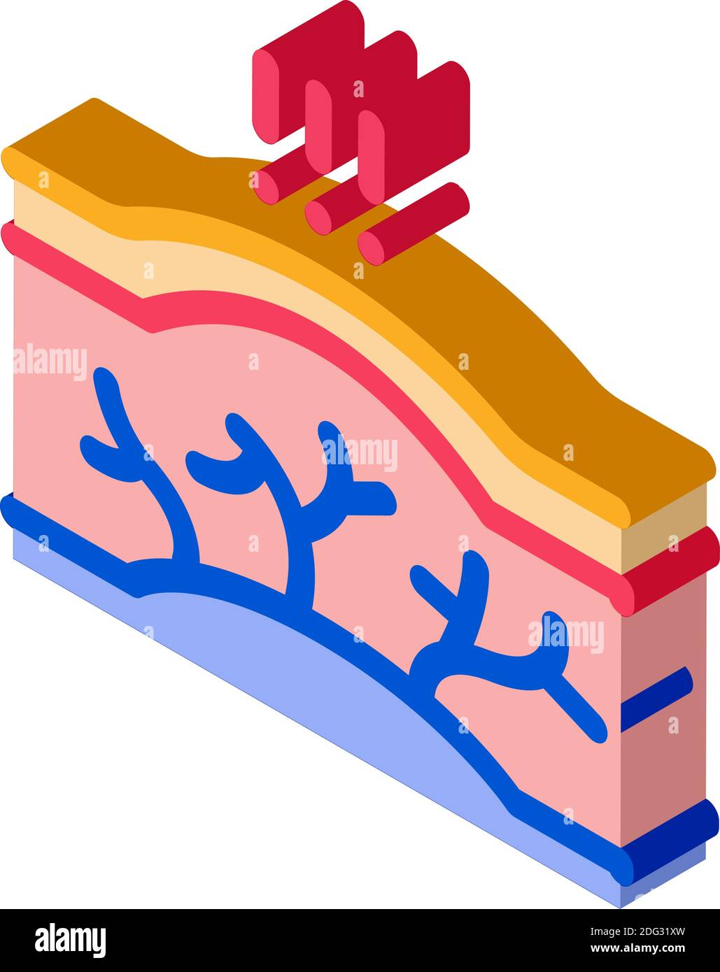 varicose veins disease isometric icon vector illustration Stock Vector ...