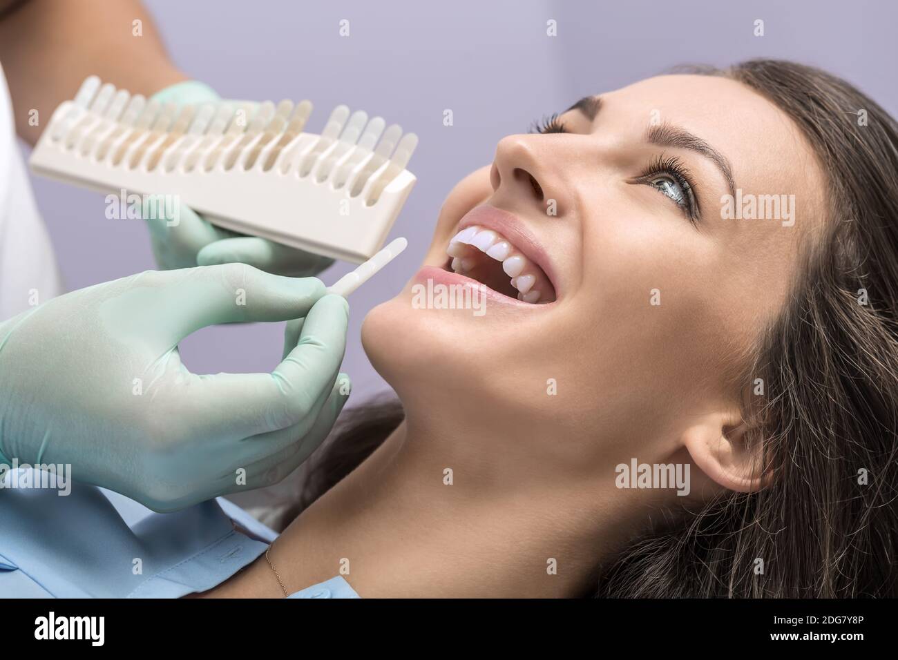 Teeth color comparison Stock Photo - Alamy