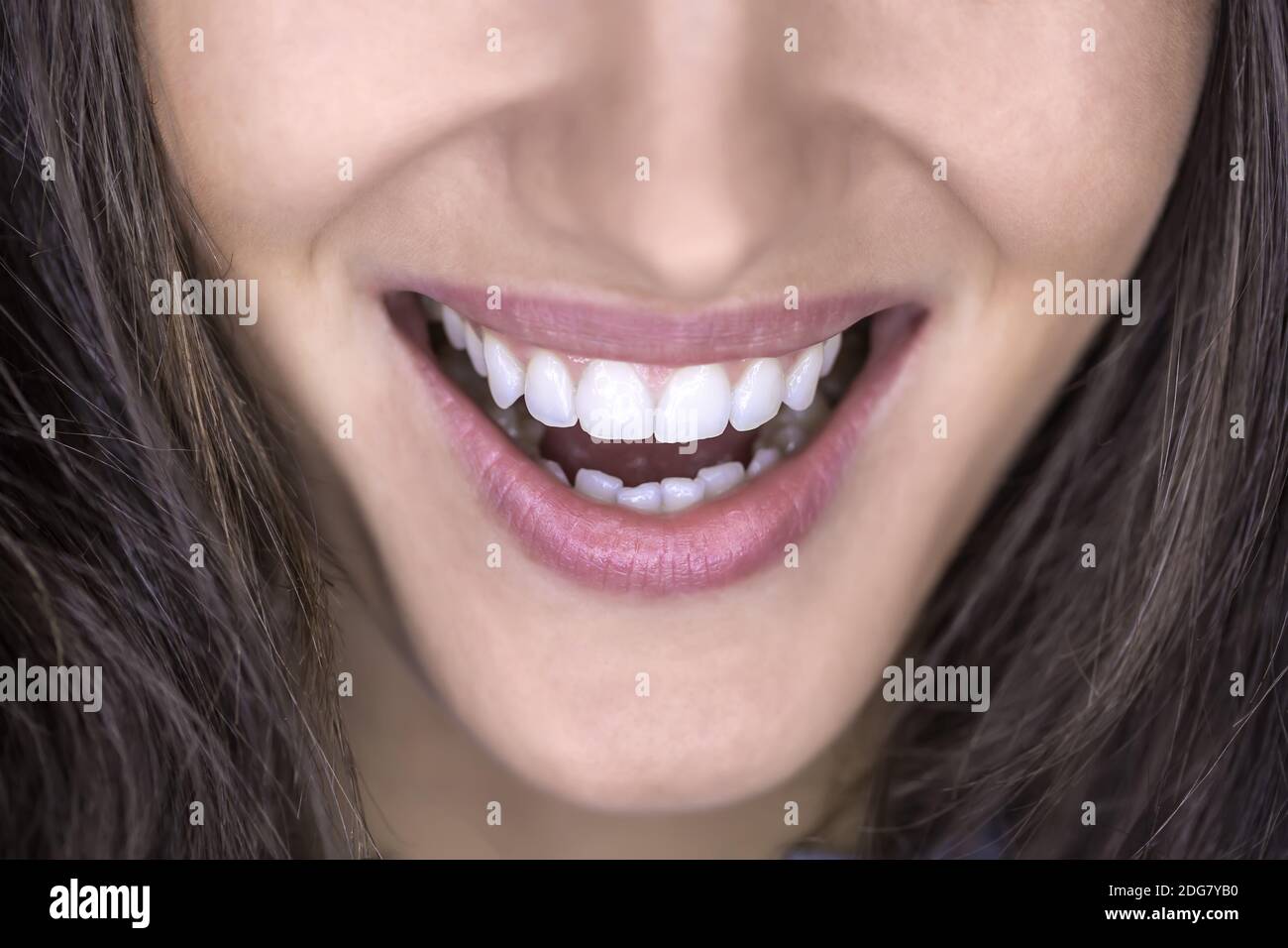 Macro photo of girl's teeth Stock Photo - Alamy