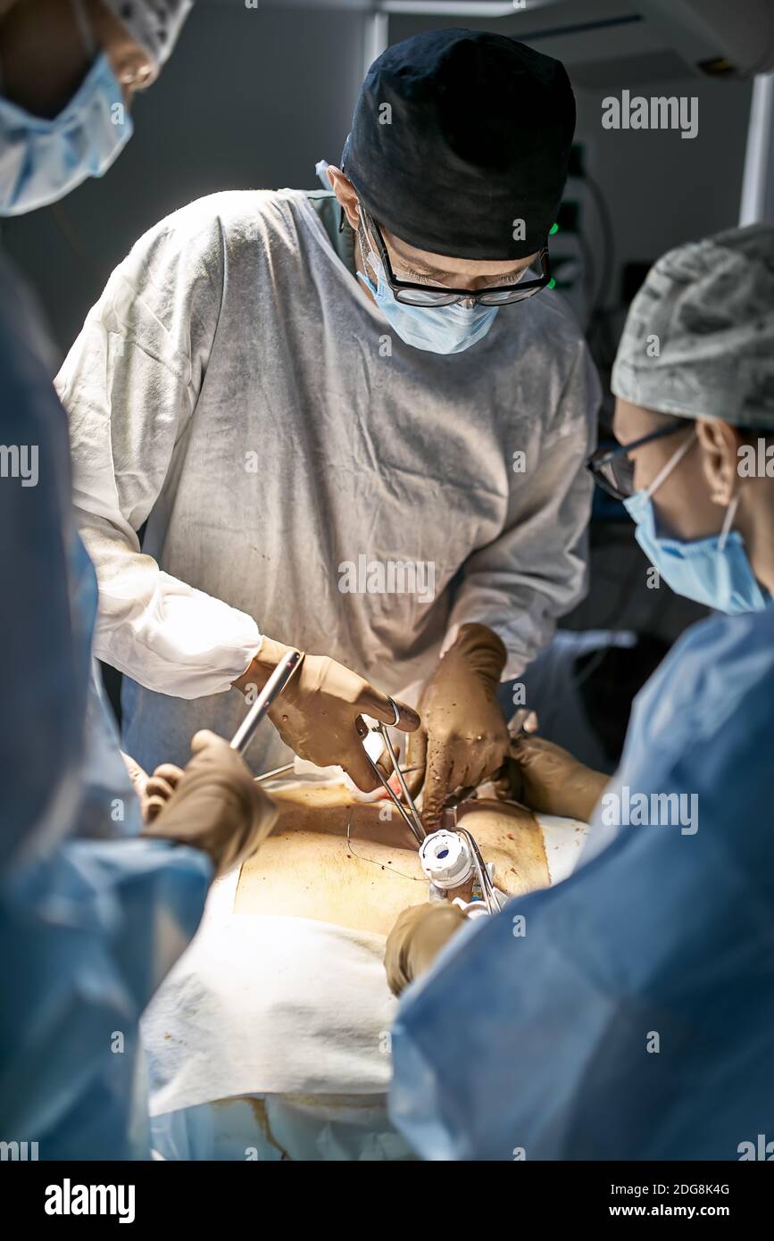 Abdominal laparoscopy operation Stock Photo - Alamy