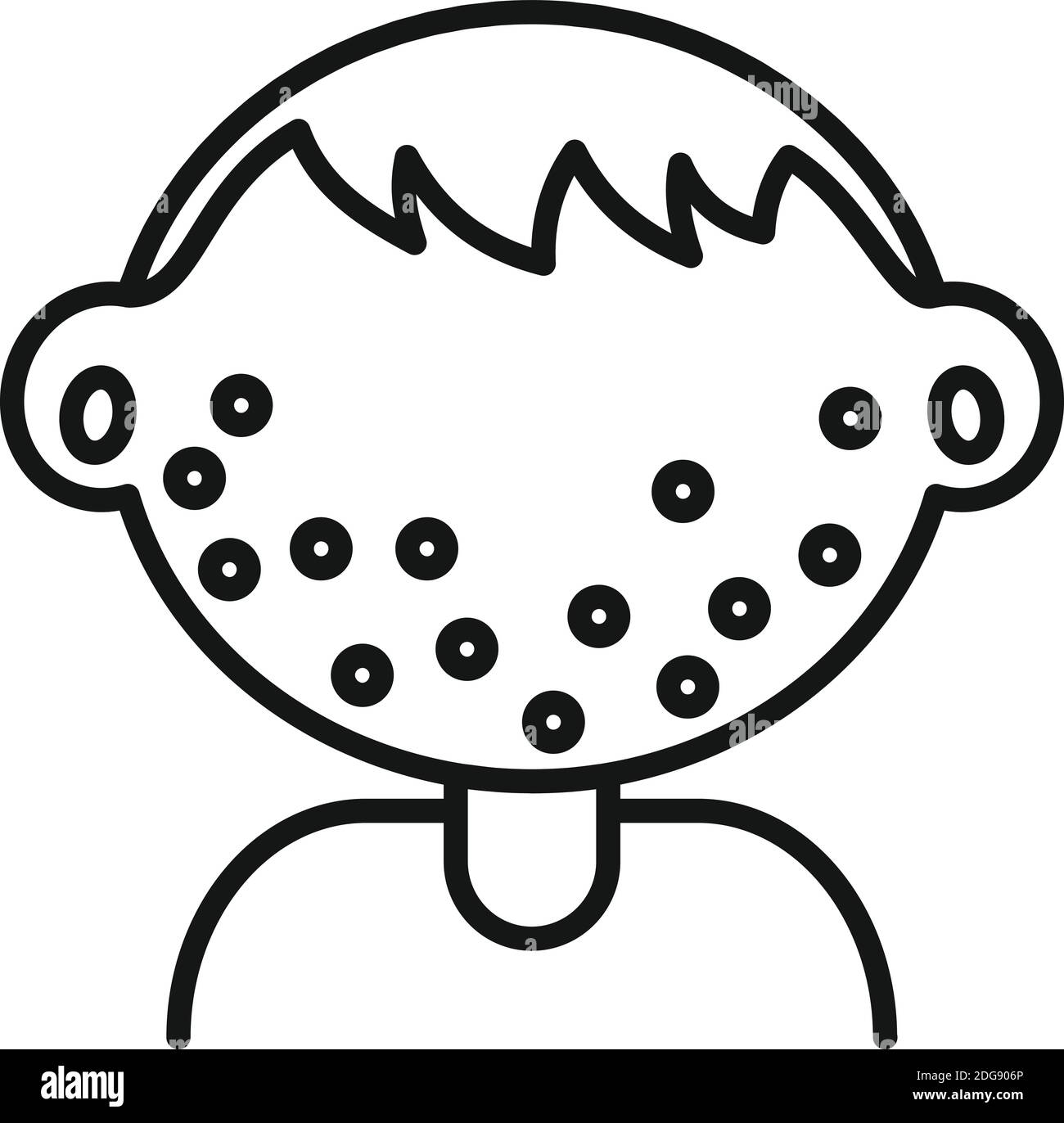 Chicken pox kid boy icon, outline style Stock Vector Image & Art - Alamy