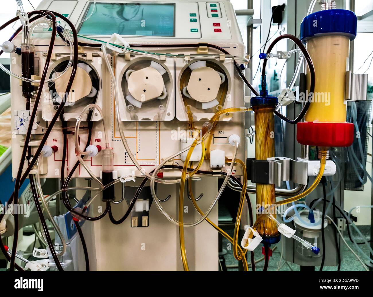 Extracorporeal Blood Purification High Resolution Stock Photography and ...