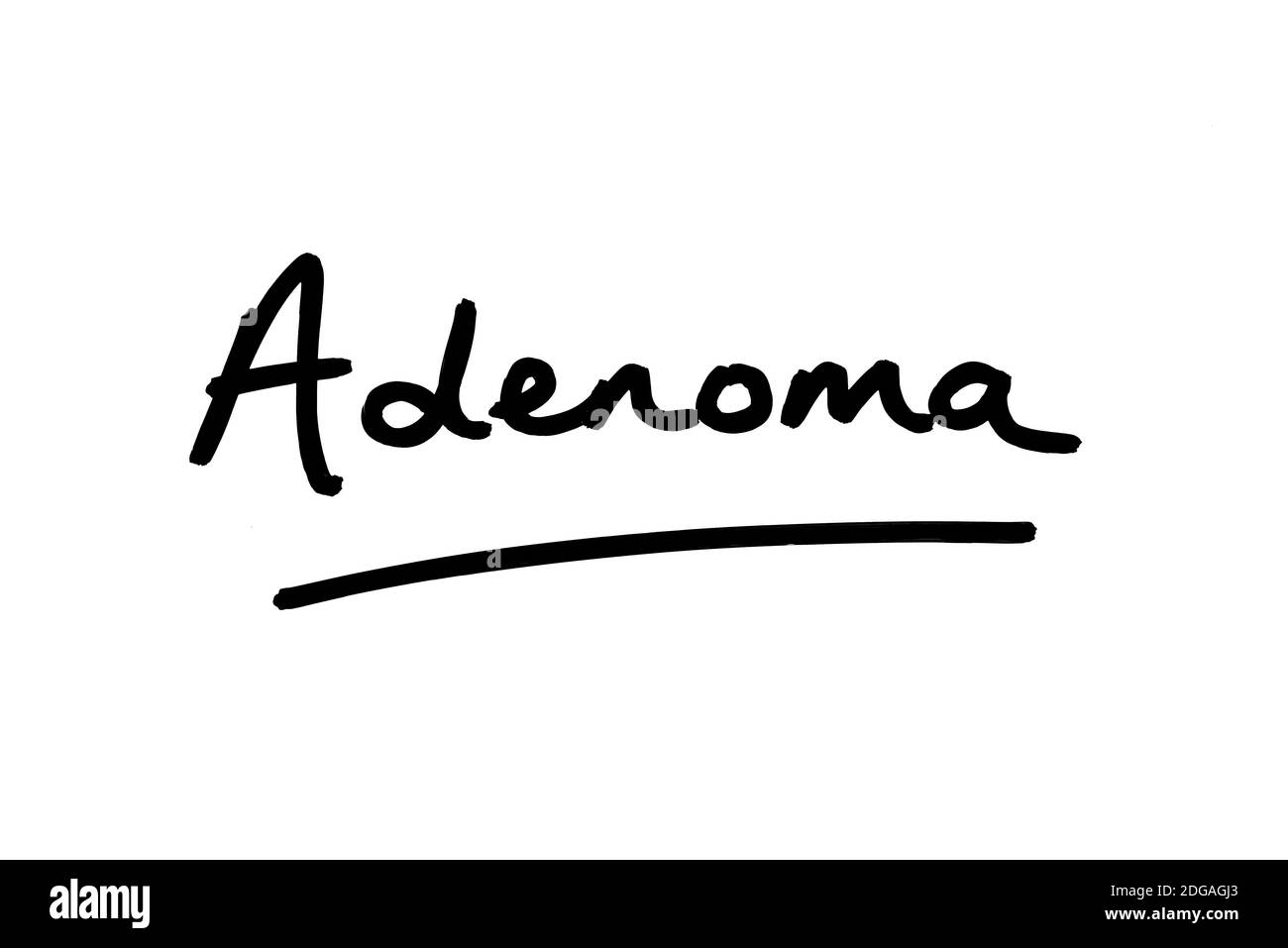 Adenoma hi-res stock photography and images - Alamy
