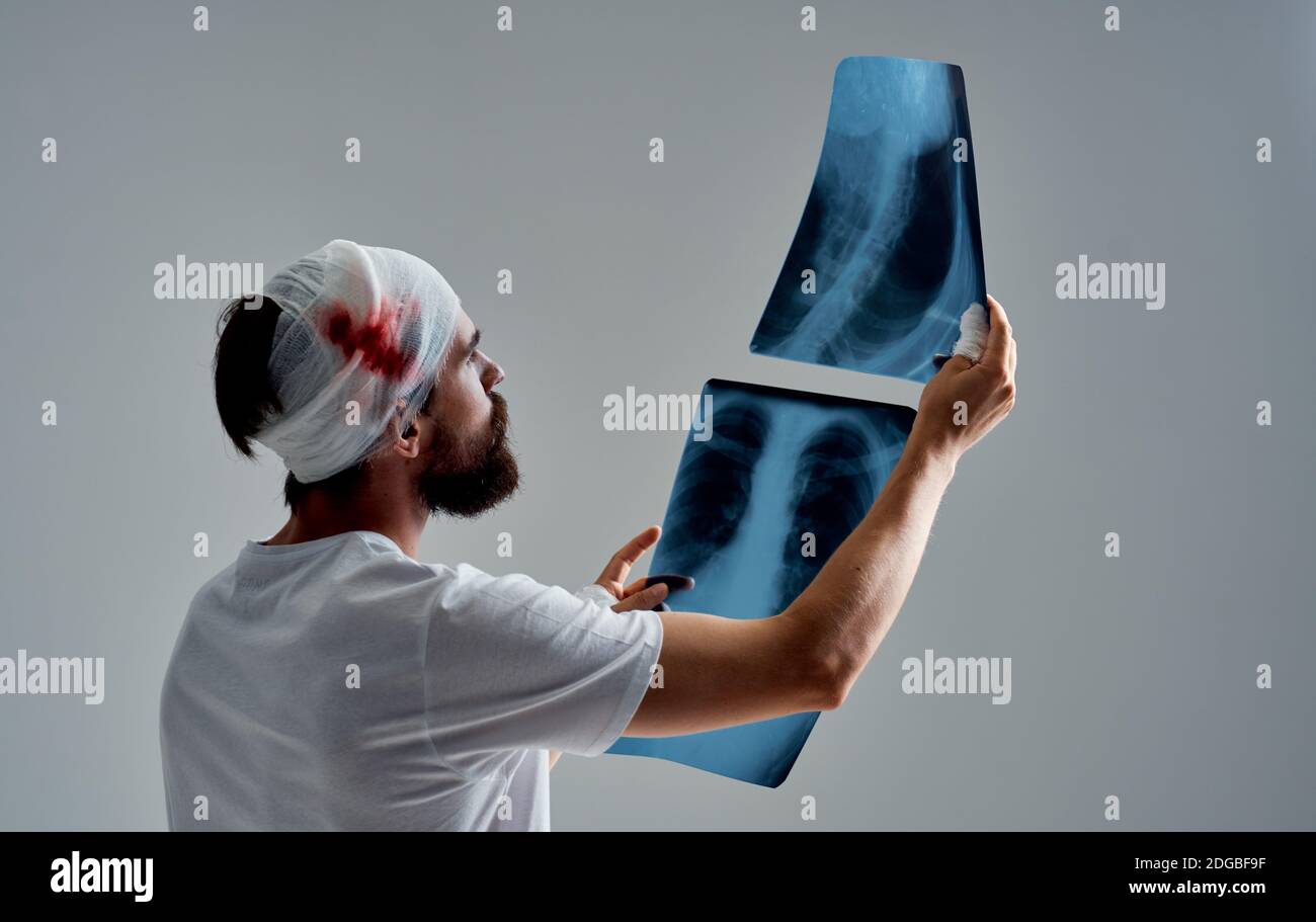 Normal shoulder x ray hi-res stock photography and images - Alamy