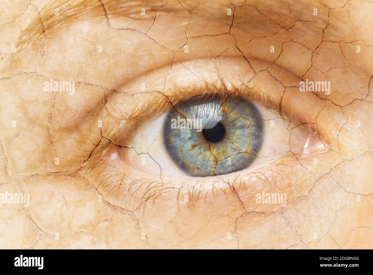 Cracked Skin. Closeup of a female eye with cracked skin. Aging process ...