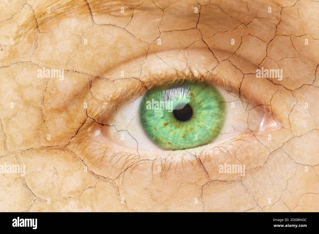 Cracked Skin. Closeup of a female eye with cracked skin. Aging process ...