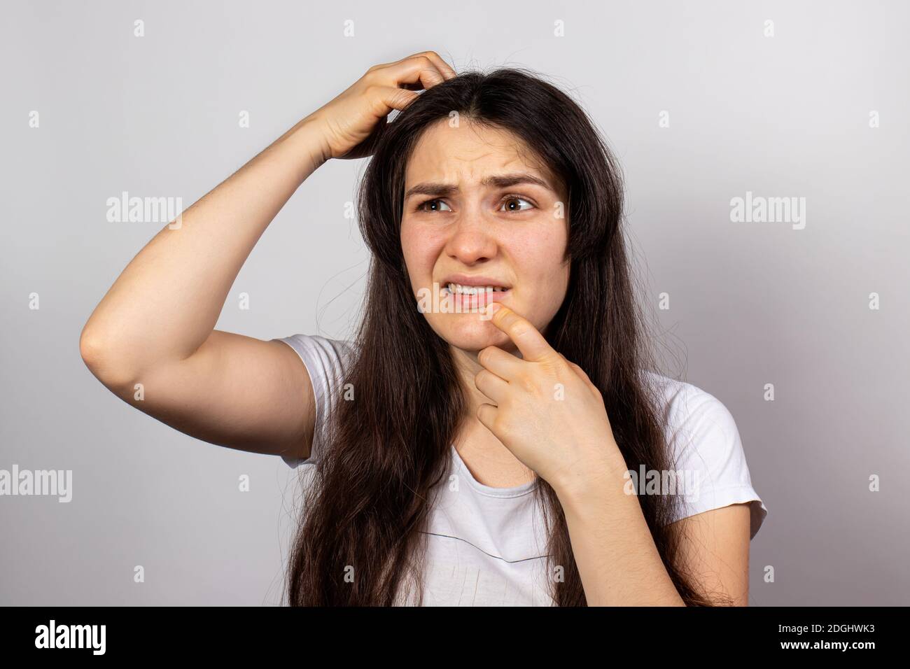 The Girl Scratches Her Head And Screams Lice In Hair Pediculosis