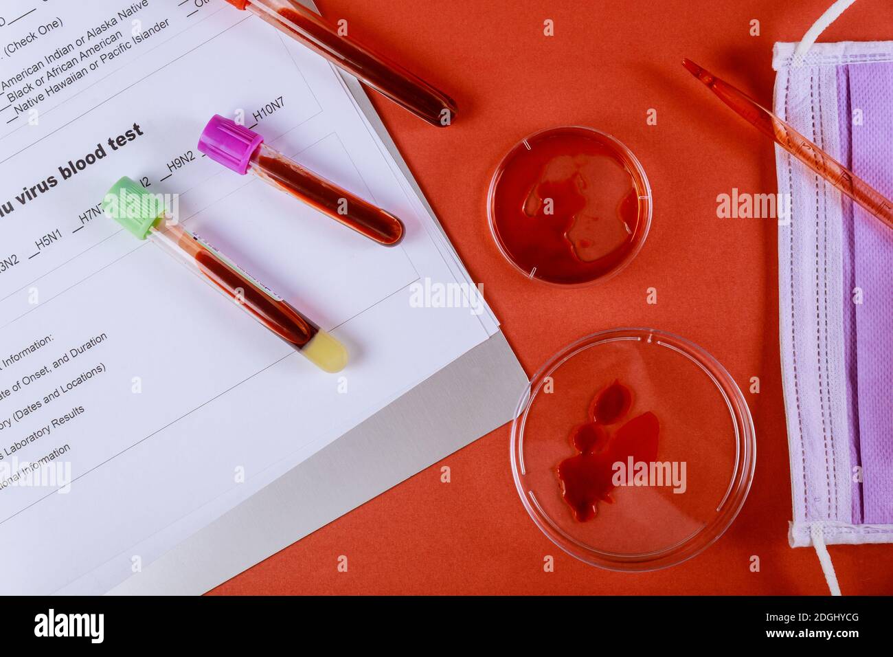 Blood in test tubes and results of blood testing positive for flu virus ...