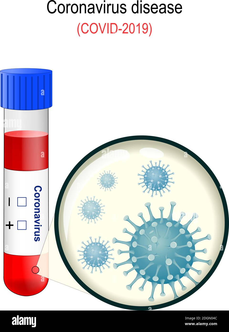 Coronavirus. 2019-nCoV acute respiratory disease. COVID-19. Corona ...