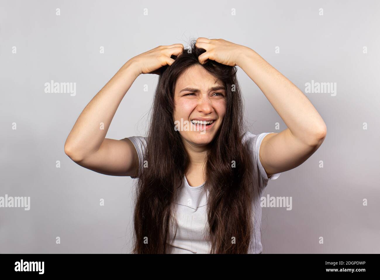 The girl scratches her head with both hands, itchy scalp due to ...