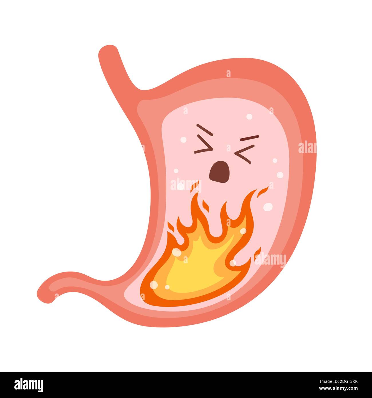 Inflamed abdomen Stock Vector Images - Alamy