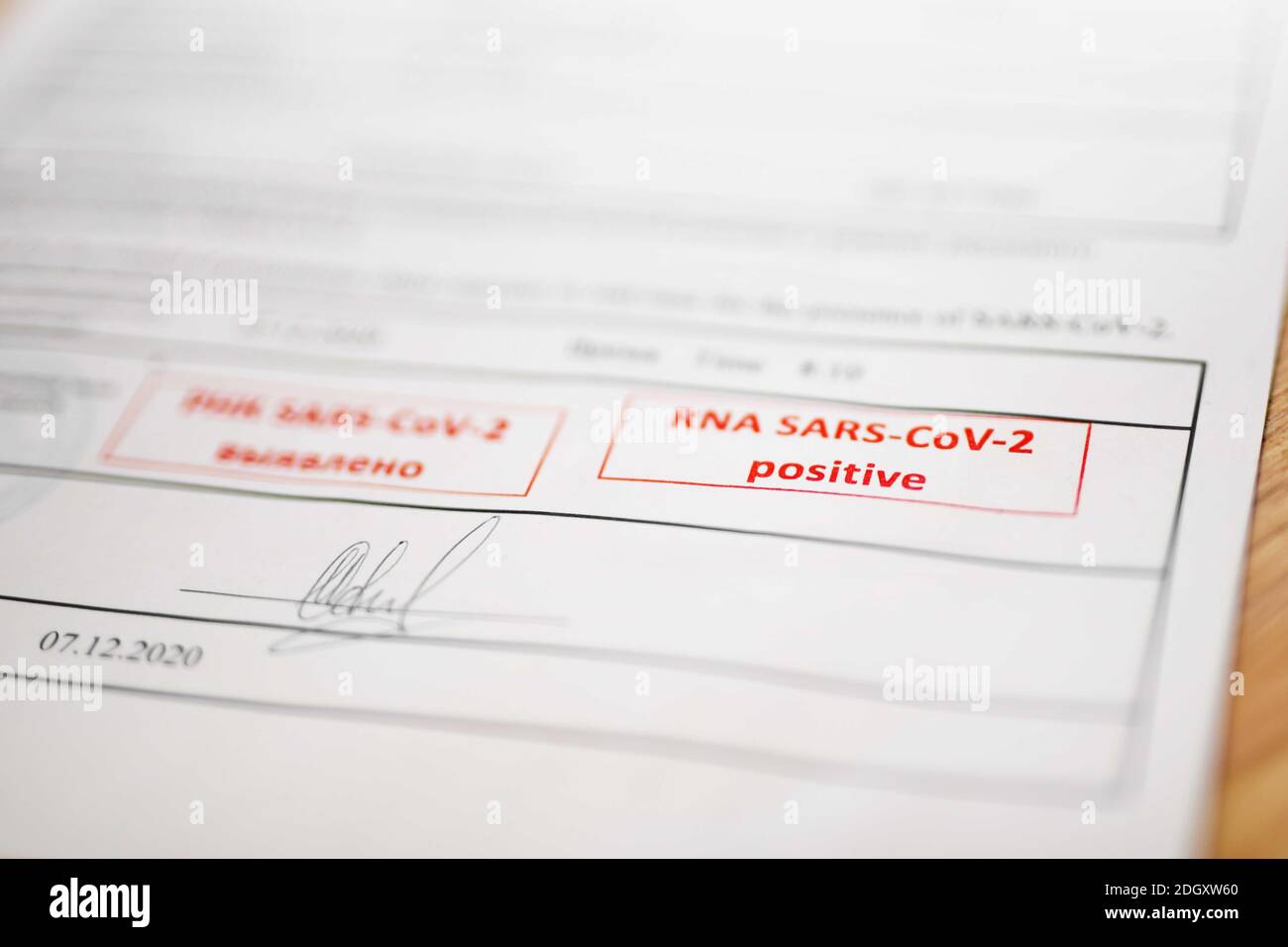 Positive test result for COVID-19 virus Stock Photo - Alamy