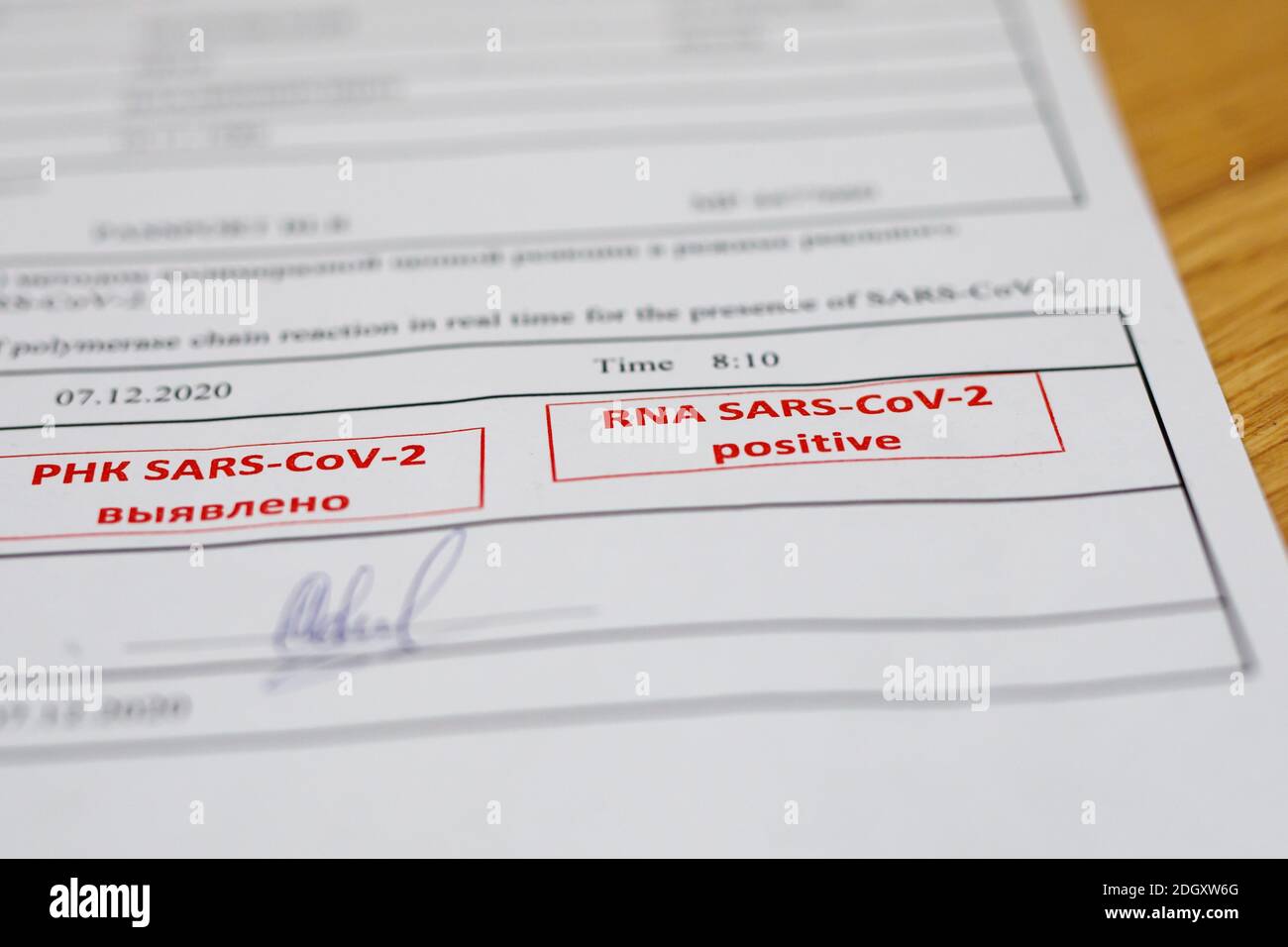 Positive test result for COVID-19 virus Stock Photo - Alamy