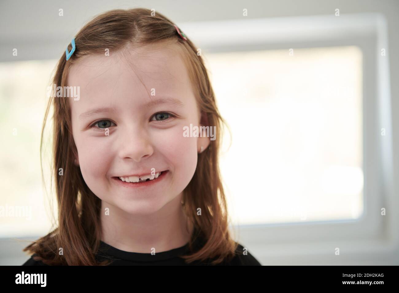 Little girl without tooth smiling Stock Photo - Alamy