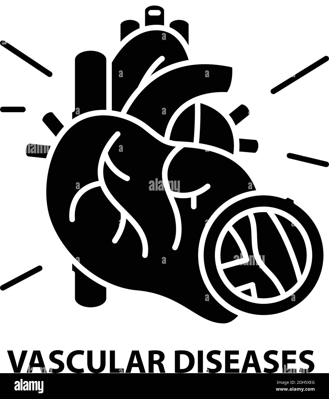 vascular diseases icon, black vector sign with editable strokes ...